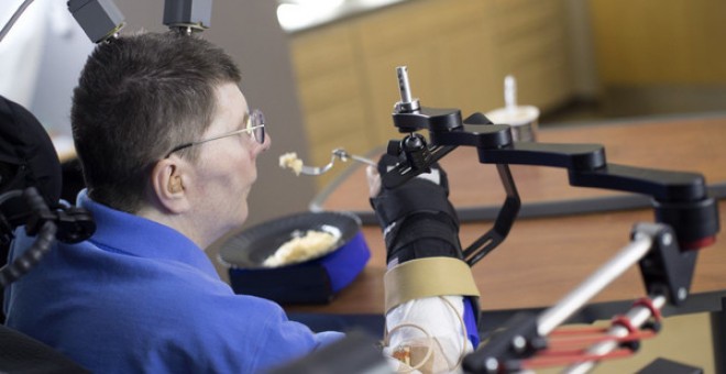 Neuroprótesis: ¿Te implantarías un chip en el cerebro? | Público