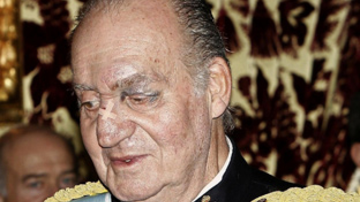 Un golpe con una puerta deja al rey con un ojo a la virulé | Público